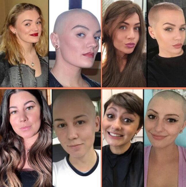 Buzzcut Frau Vorher Nachher