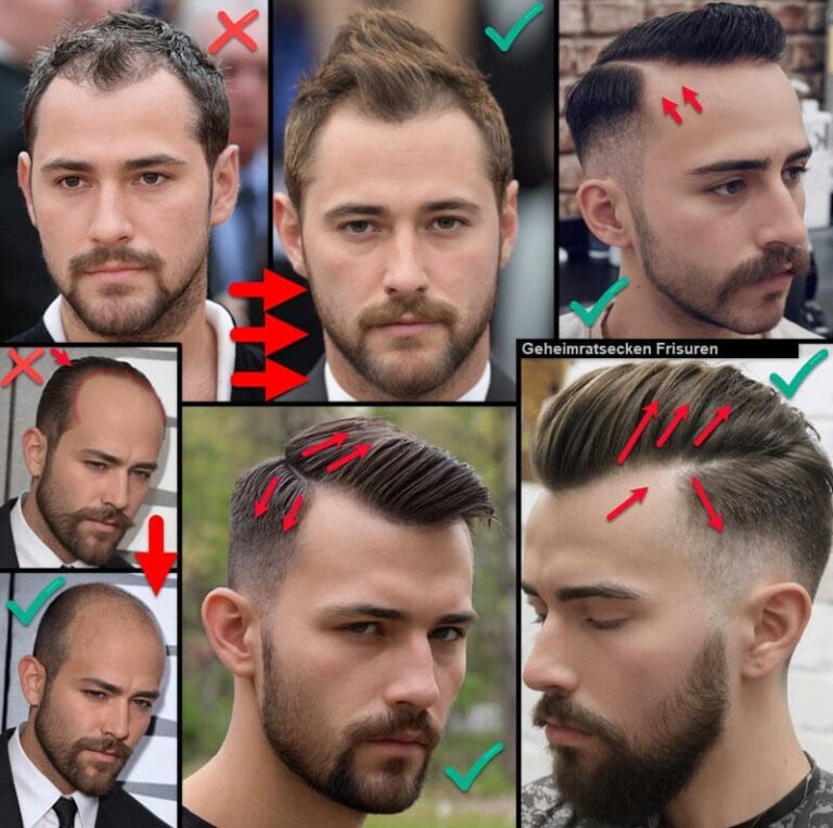 Faszinierend Kurzhaarfrisuren Fur Manner Mit Geheimratsecken Bild